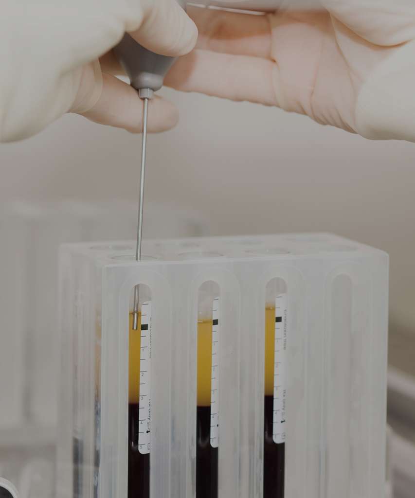 PRGF – ENDORET | Dental Treatments | London | Dental Care Centre